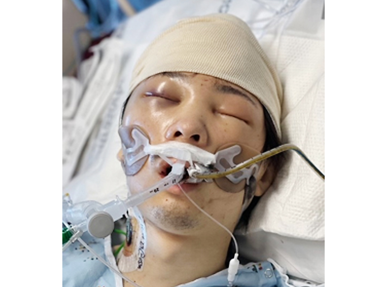 Public Assistance Needed to Identify Unknown Patient - Rafu Shimpo